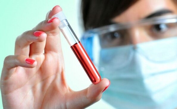 AIDS: o que é uma pessoa soropositiva? [resumo]